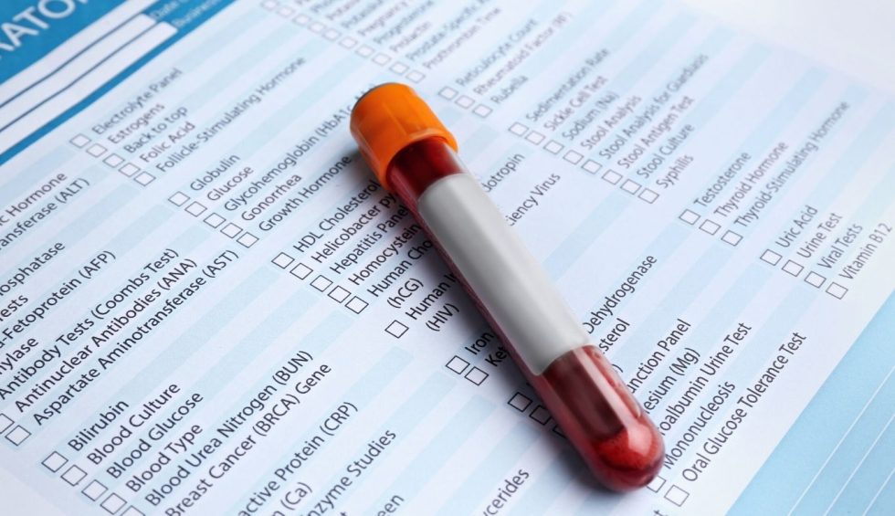 Bien comprendre les résultats de vos analyses médicales - BIO AHWA DU RAIL